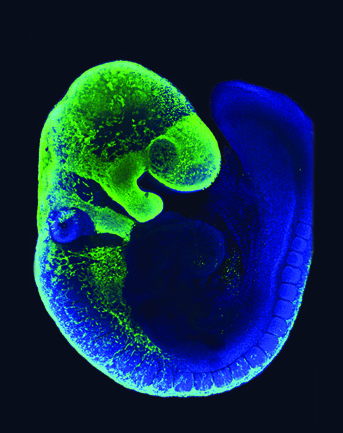 Les cellules des crêtes neurales : « la seule chose intéressante » chez ...