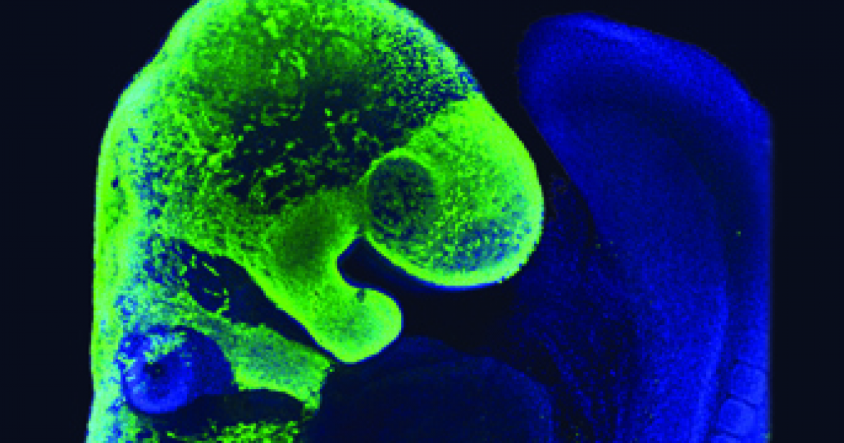 Les cellules des crêtes neurales : « la seule chose intéressante » chez ...